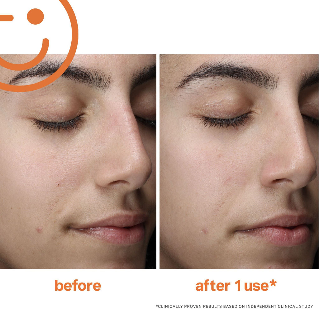 ExfoliKate® Cleanser Mini – Kate Somerville UK