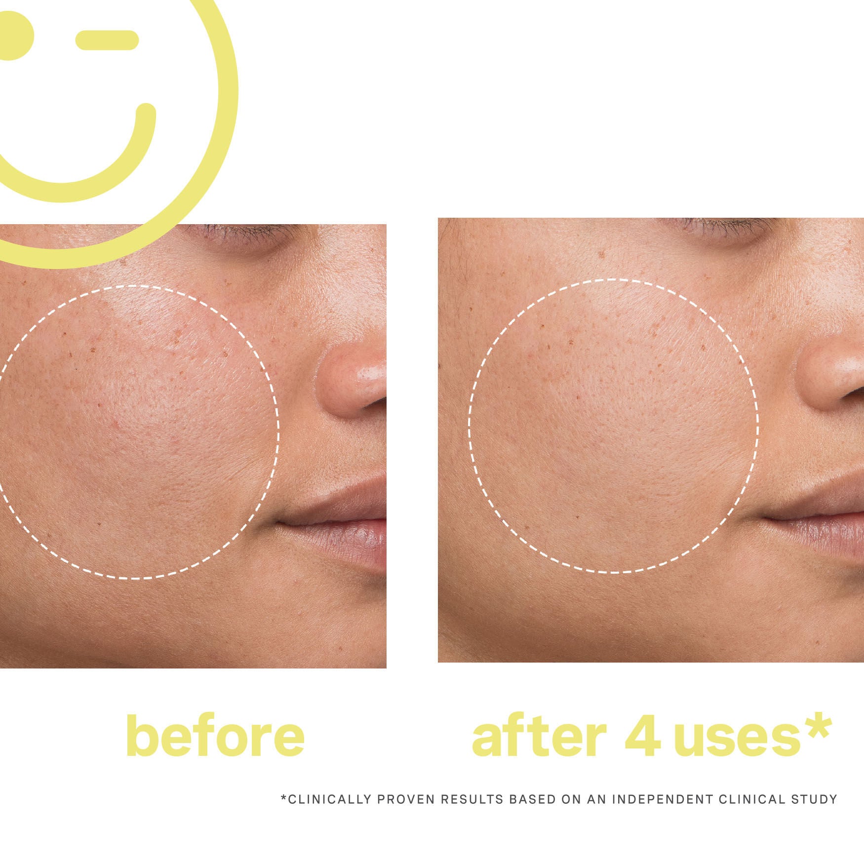 30% Vitamin C Brightening Face Mask – Kate Somerville UK